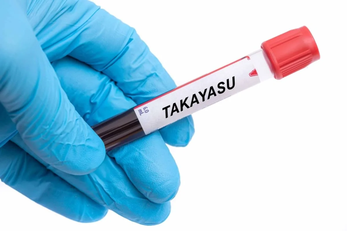 Boala Takayasu: cauze, simptome, tratament | Dr. Max Farmacia