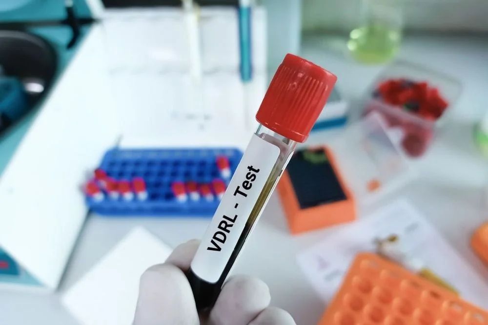 Test VDRL: ce este si cand se recomanda acest test | Dr.Max Farmacie
