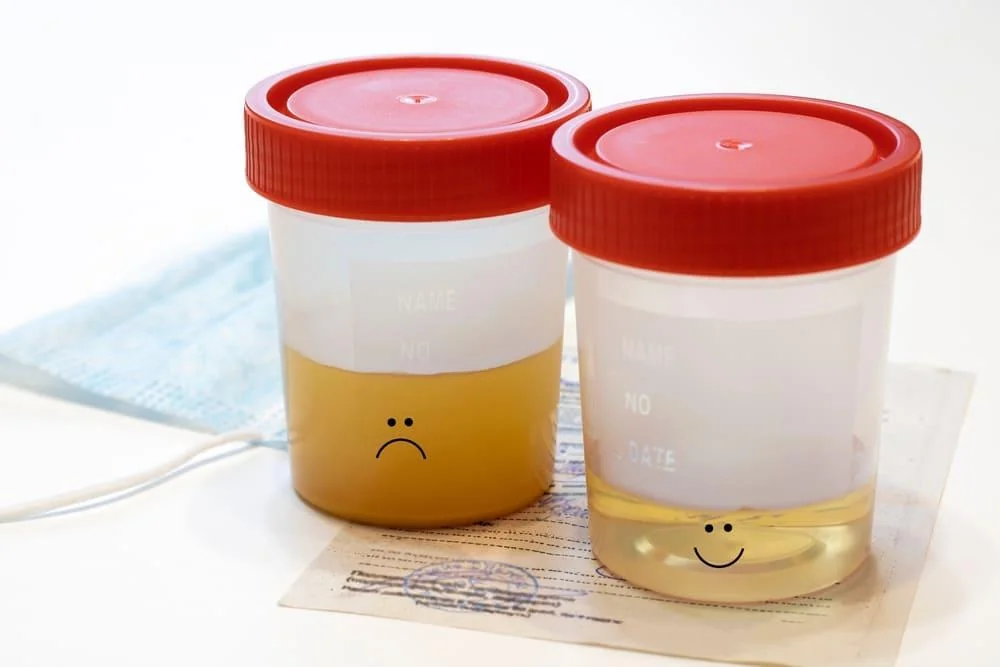 Mucus in urina: ce inseamna si ce trebuie sa stii? | Dr.Max Farmacie